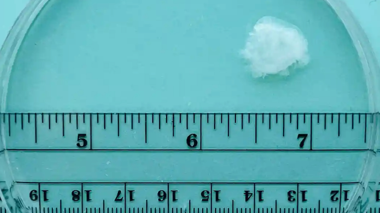 What does a pregnancy look like in the first 10 weeks? - CGTN